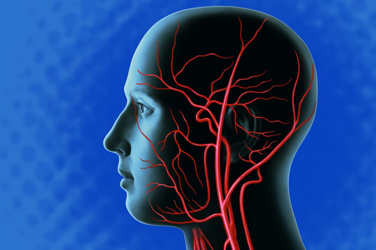 Vaskulitis im Kopfbereich früh erkennen